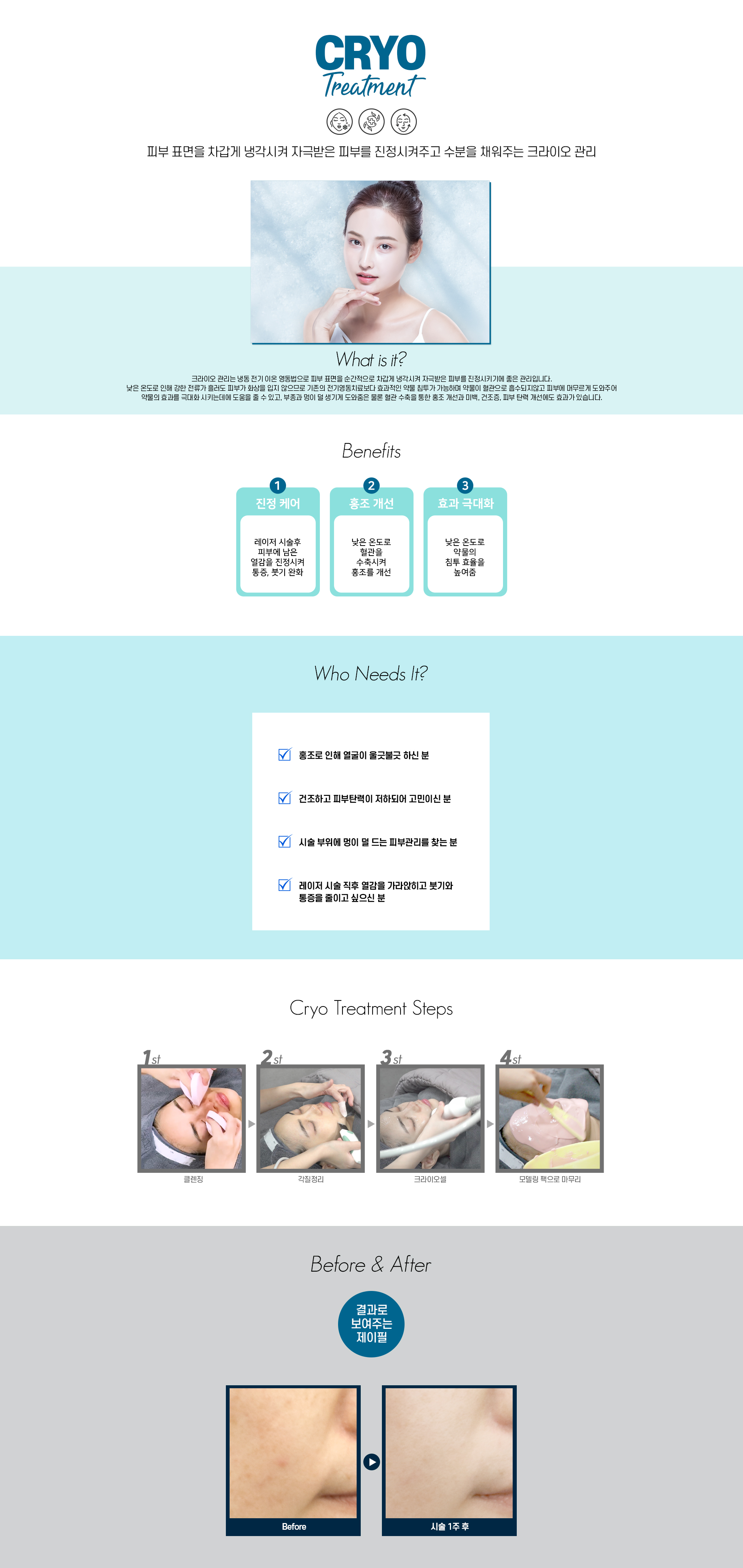 크라이오관리 제일이쁜느낌 제이필의원 홍대 피부과 리프팅 전담병원울쎄라 인모드 슈링크 올리지오 필러 장인 스킨부스터리쥬란힐러 엑소좀맛집